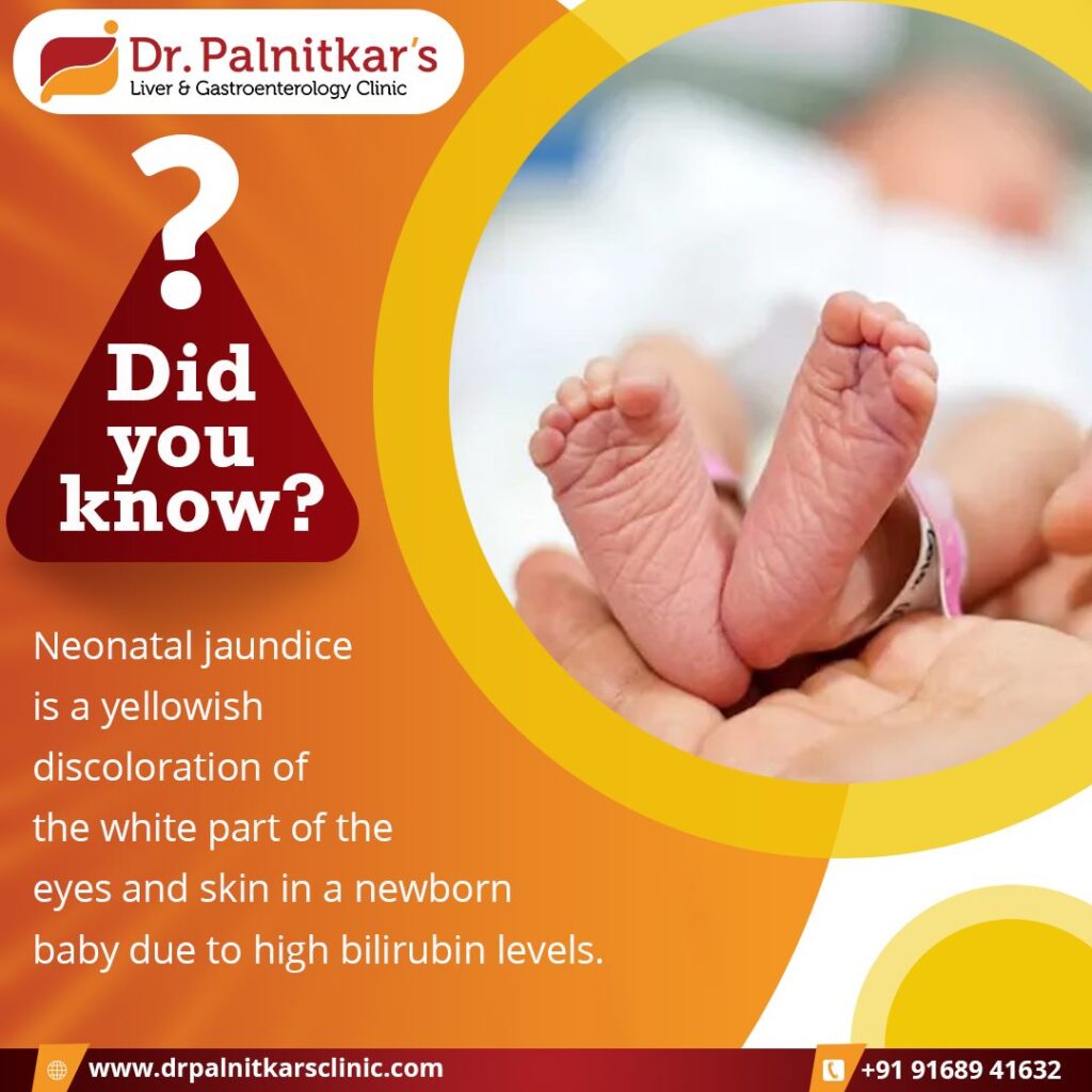 Did You Know? How is newborn jaundice treated… - Dr Sachin Palnitkar
